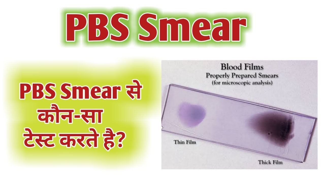 PBS slide | Periferal blood smear | PBS test - YouTube