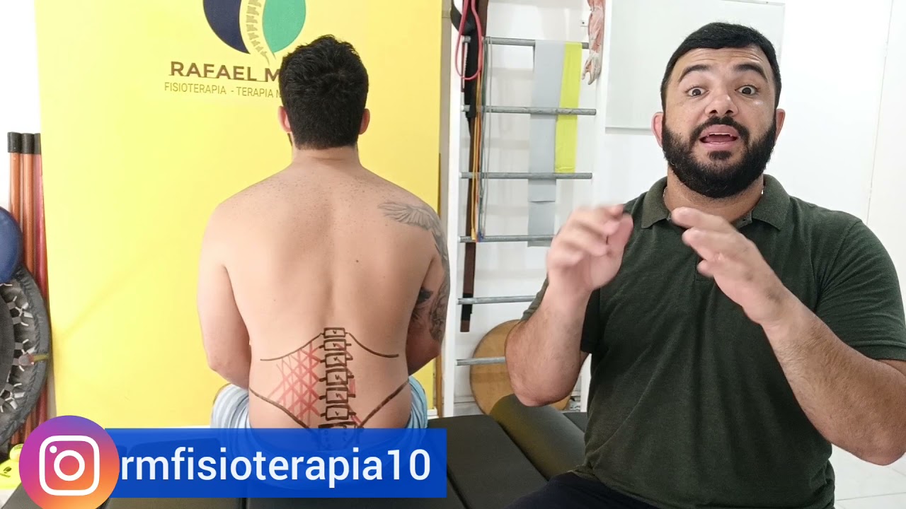 Localização Anatômica - Espinha Íliaca Postero Superior (EIPS) e Base ...