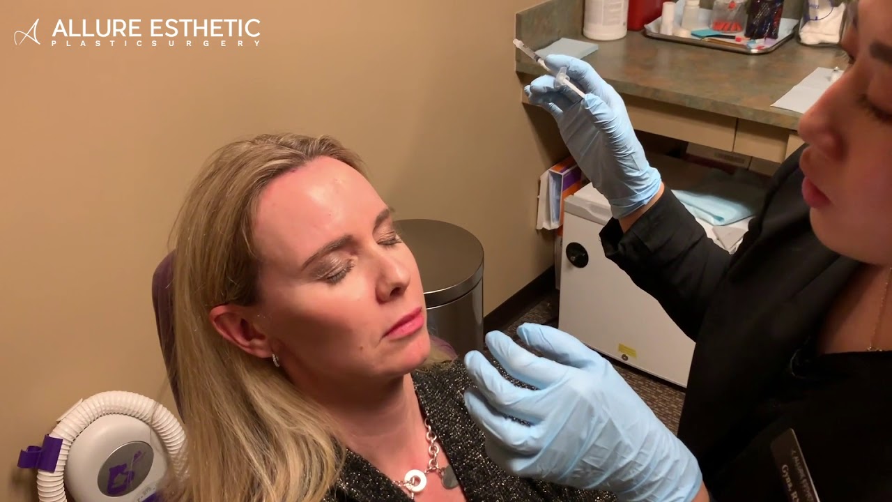 Botox Consultation & Injections at Seattle's Allure Esthetic - YouTube