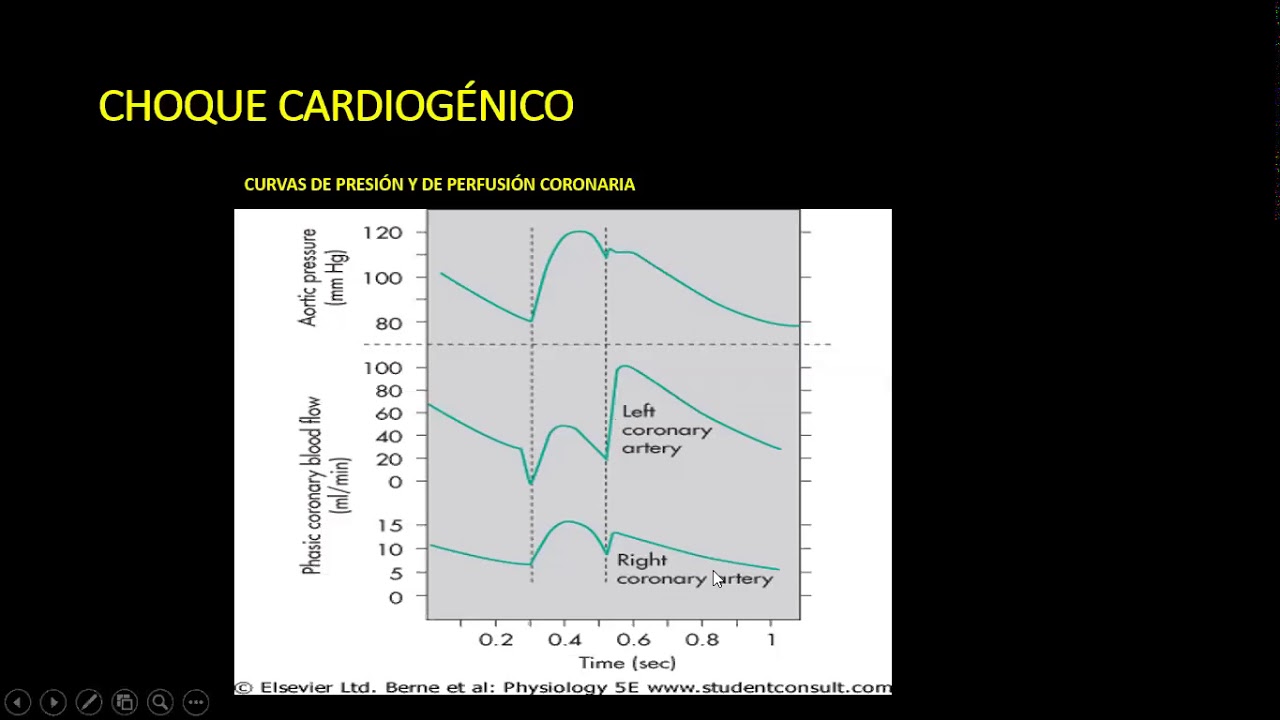 Choque Distributivo Cardiogenico at Caitlyn Tooth blog