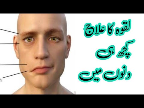 Laqwa ka Ilaj (BELL'S PALSY) how to Treat #youtube #video # ...