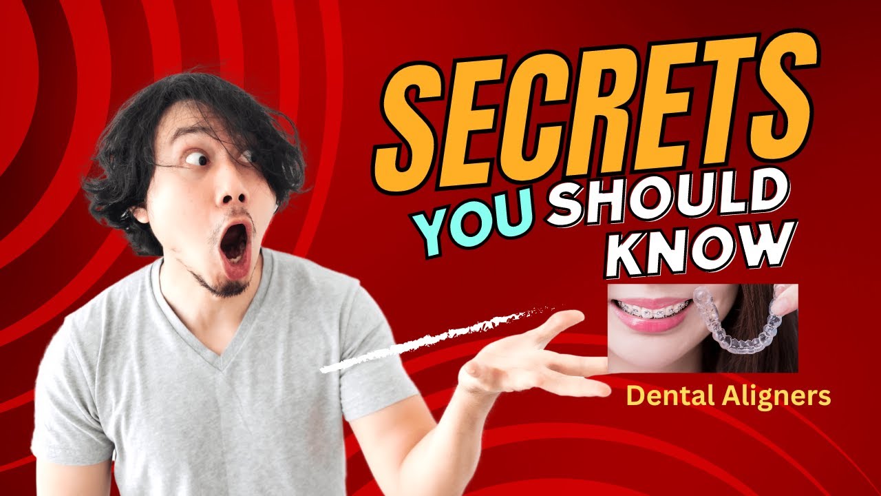 Complete Guide to Dental Aligners: Benefits, Process, and FAQs ...