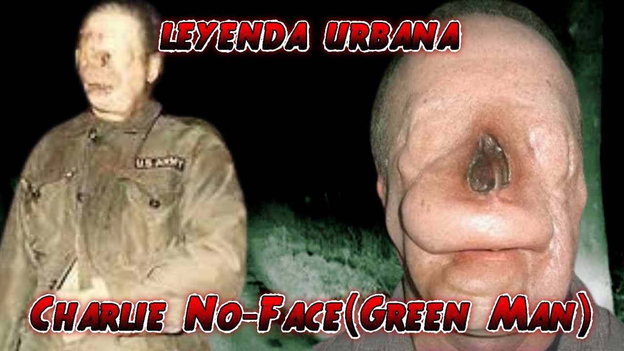 Un accidente lo dejó sin rostro, Raymond Robinson Charlie No-Face(Green ...