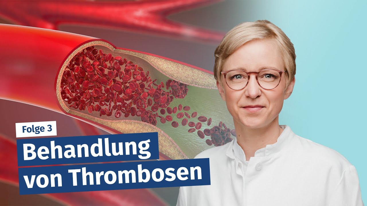 Behandlung von Thrombosen - YouTube