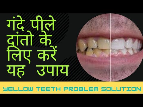 सरसों के तेल और नमक से गंदे पीले दांतो का इलाज /white teeth yellow ...