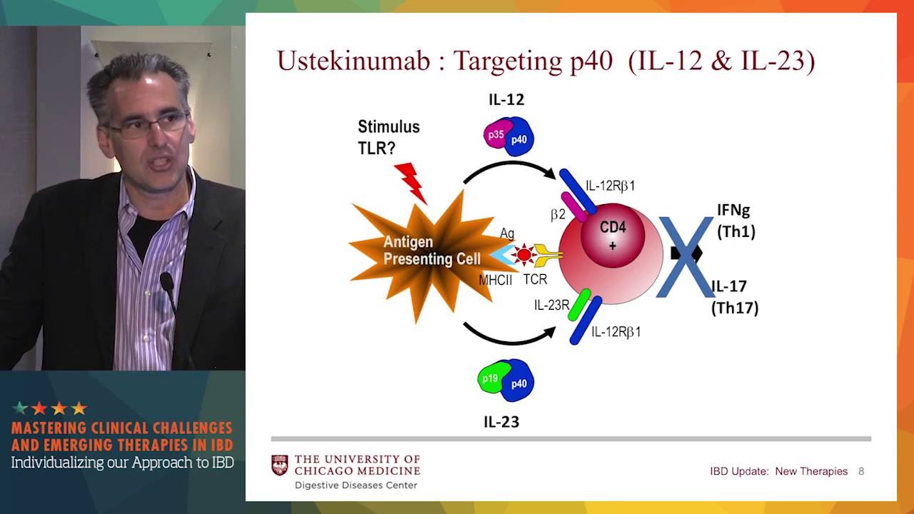 Selection and use of the new and coming therapies for IBD? Who? When ...