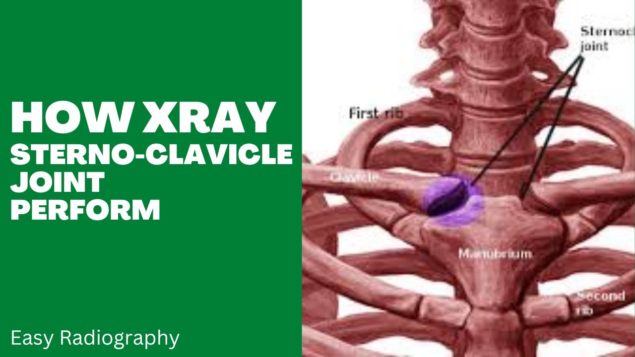 X-ray sterno-clavicle joint/Sterno-Clavicle joint x-ray/Ap/PA/Oblique ...