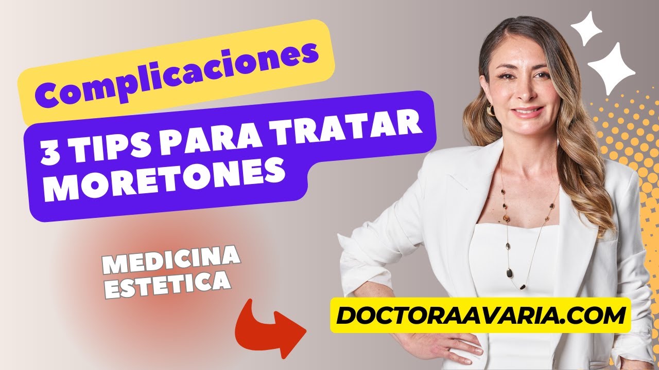3 Tips para Tratar Moretones por un Tratamiento de Medicina Estética ...