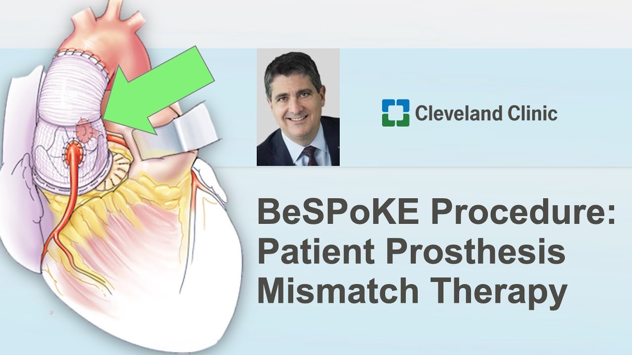 Cardiac Innovation: The BeSPoKE Procedure for Patient Prosthesis ...