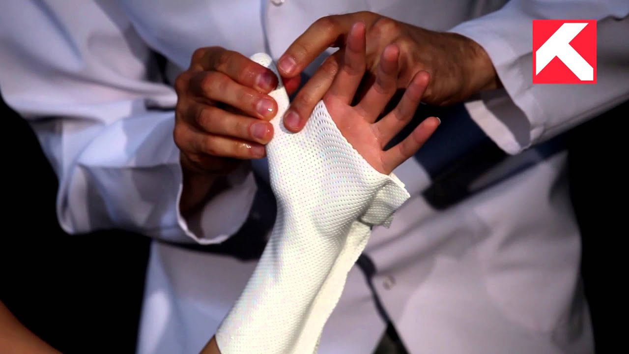 Circumferential forearm-based static Wrist Thumb Orthosis - YouTube