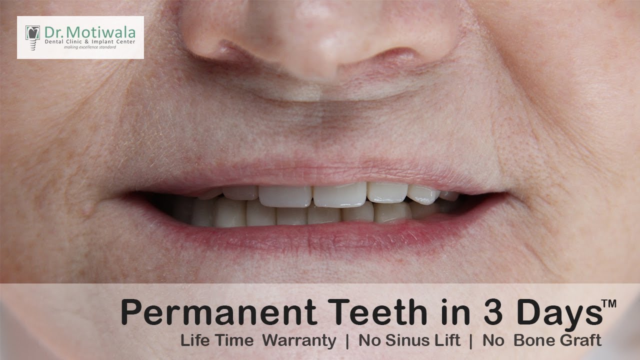 German woman shares her experience of full mouth dental implant in ...