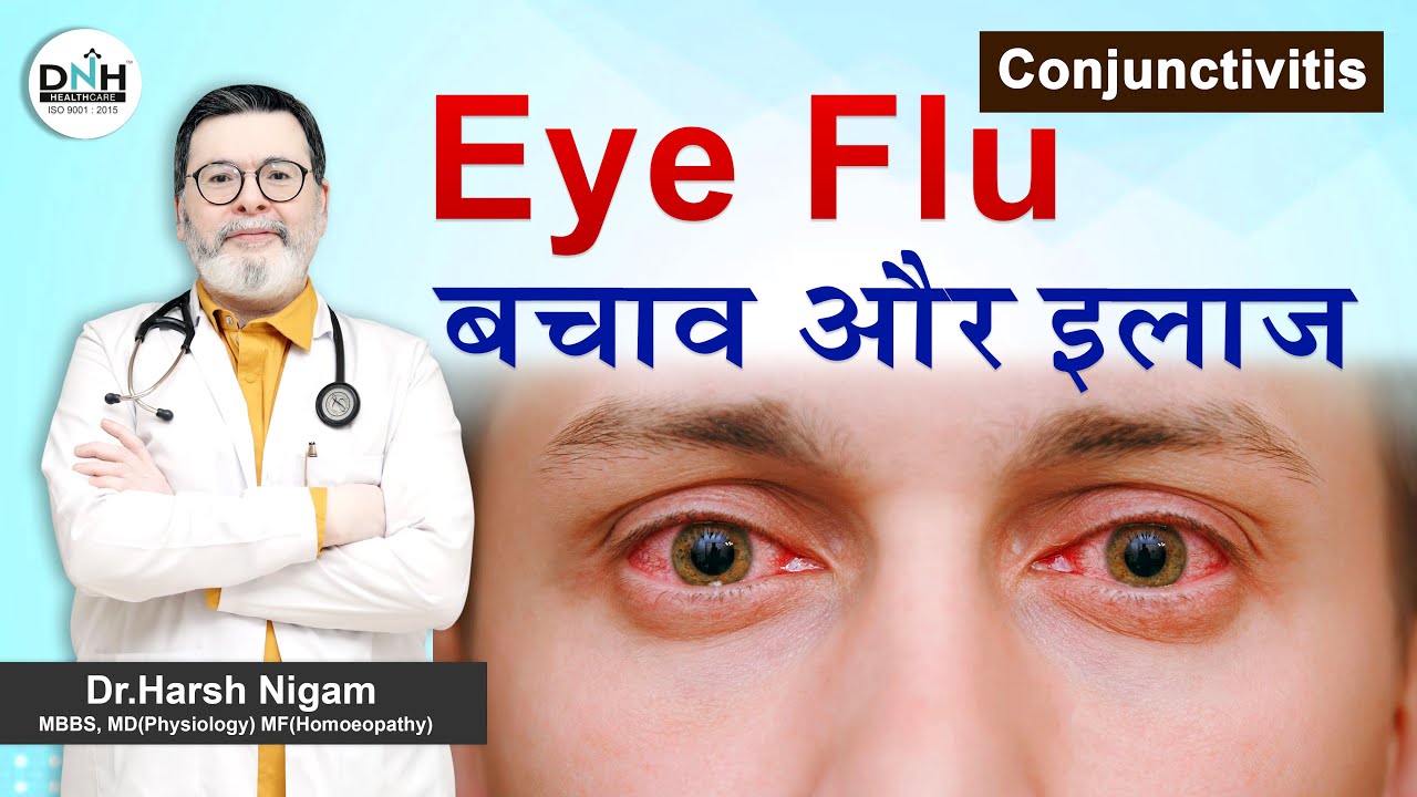 Eye flu बचाव और इलाज || Eye flu prevention and treatment - YouTube