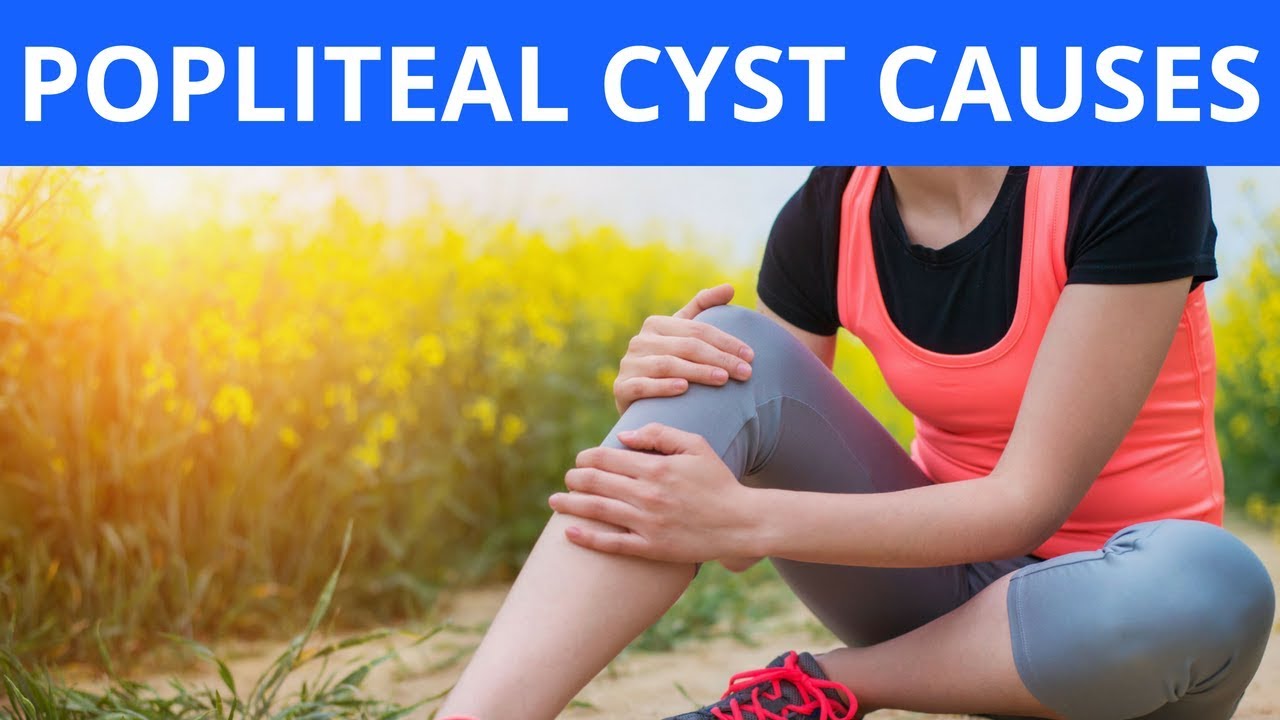 Popliteal Cyst Causes - YouTube