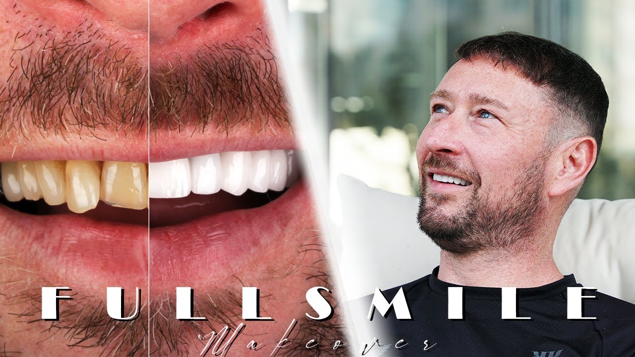 Full Smile Makeover / Testimonial - YouTube