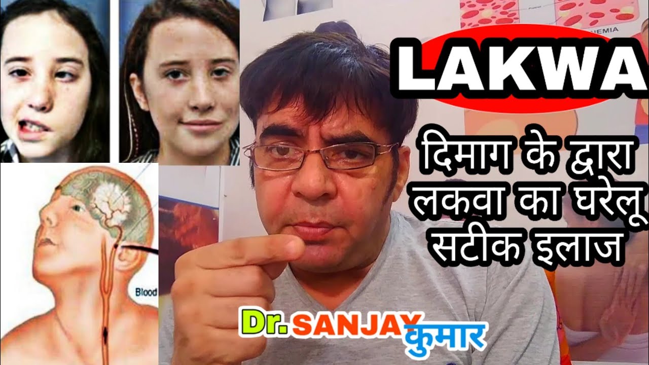 Lakwa Ka ilaj | Lakwa Marna : Paralysis - Treatment, Symptoms and ...