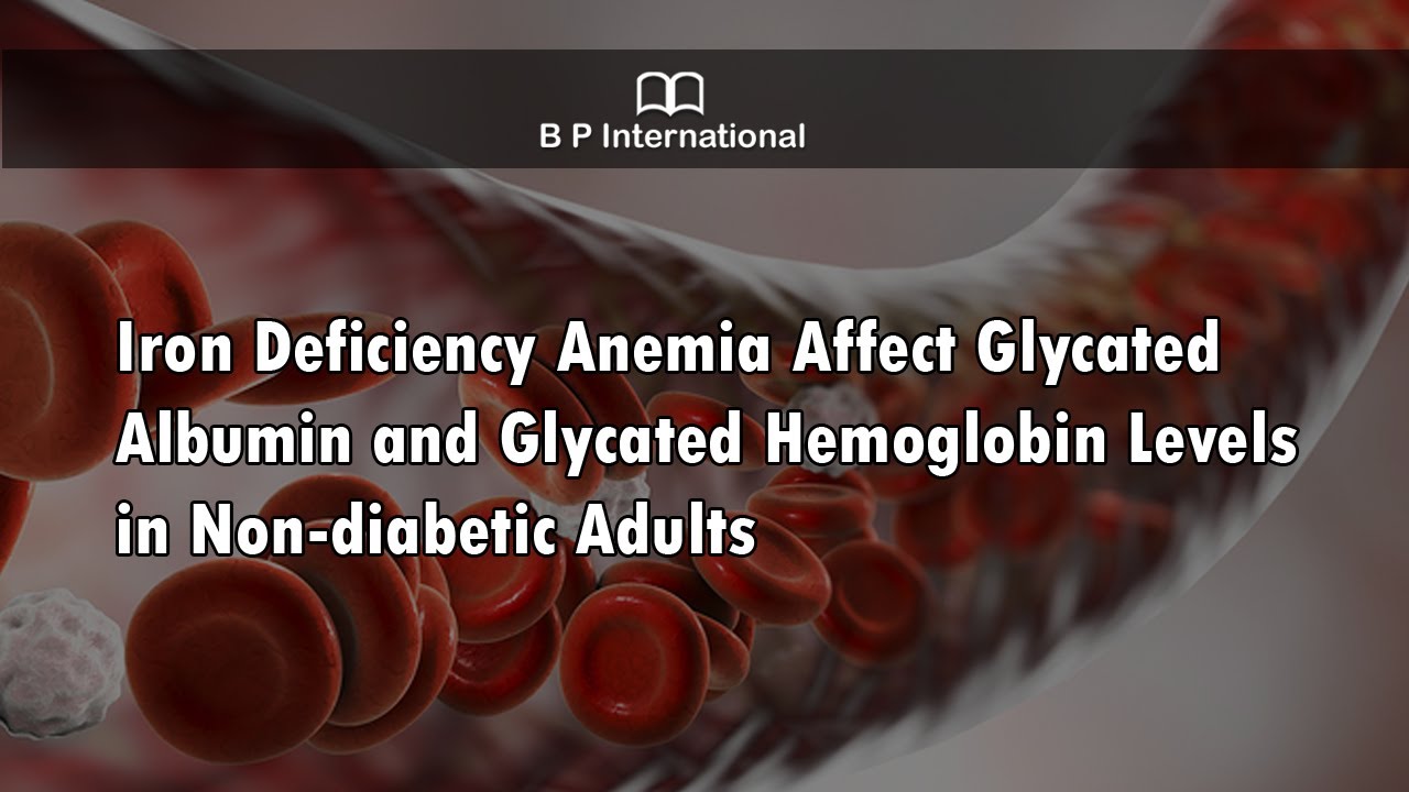 Iron Deficiency Anemia Affect Glycated Albumin and Glycated Hemoglobin ...