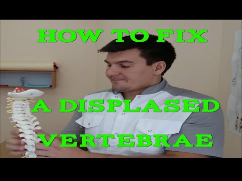 How to fix a displaced vertebrae. Vertebral subluxation