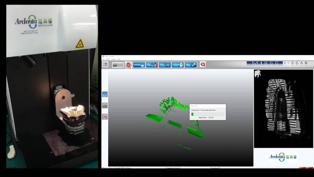 Phase Shift Dental Scanner demo-ardenta desktop dental scanner 2016 ...