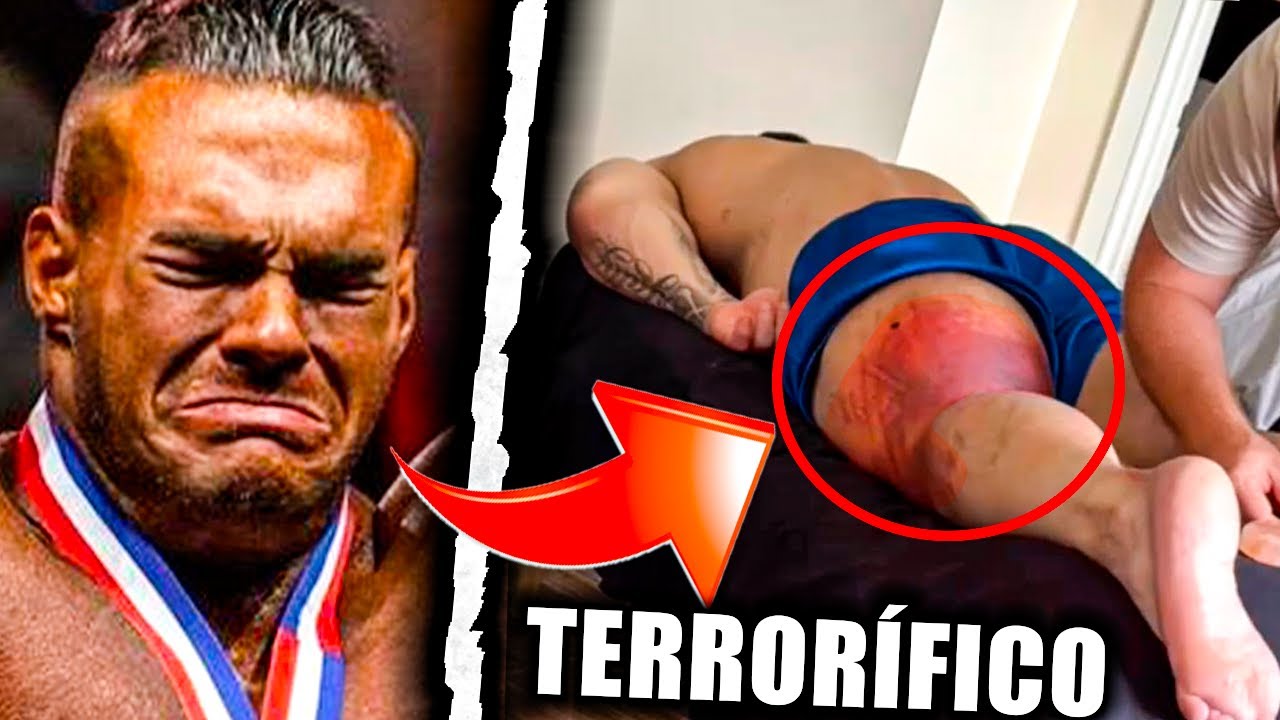 LA TRÁGICA HISTORIA tras la LESIÓN de NICK WALKER 😨 Fuera del MR ...