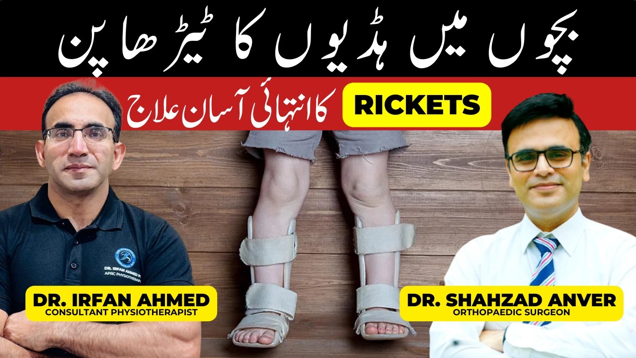 How to Fix Bow Legs & Vitamin D Deficiency in children | How to Treat ...