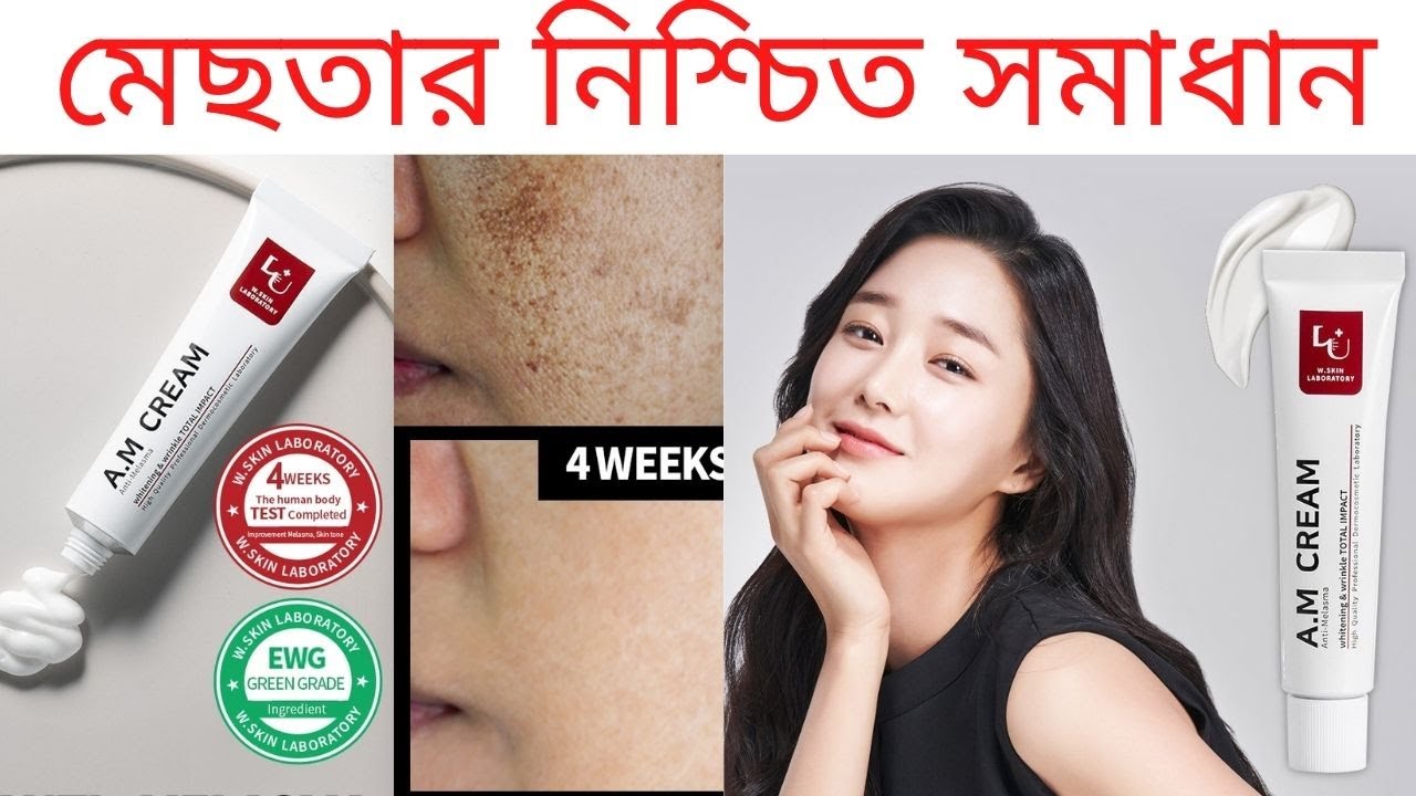W. Skin A.M Cream & A.M Boosting Serum % Anti-Melasma % মেছতার সমাধান ...