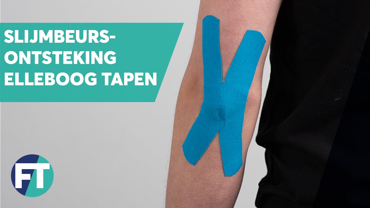 Slijmbeursontsteking elleboog tapen » Instructie » FysioTape - YouTube