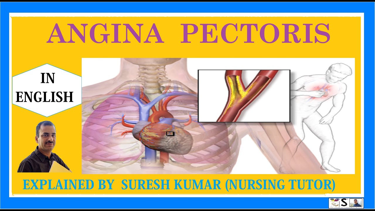 ANGINA PECTORIS IN ENGLISH | TYPES OF ANGINA | CAD - YouTube