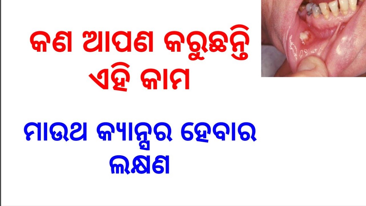 Symptoms Of Mouth Cancer | Varkha Mohapatra| Odia Health tips| Signs Of ...