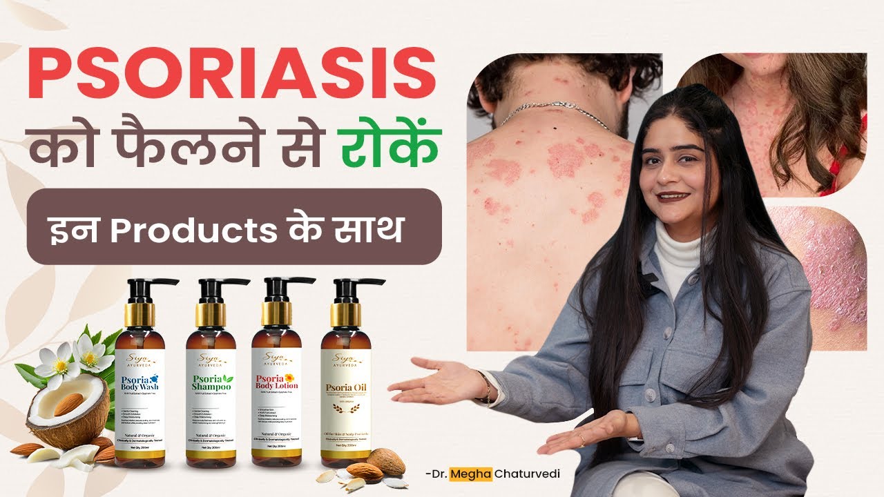 Best Psoriasis Shampoo, Oil, Lotion and Body wash | Psoria Oil by Siya ...