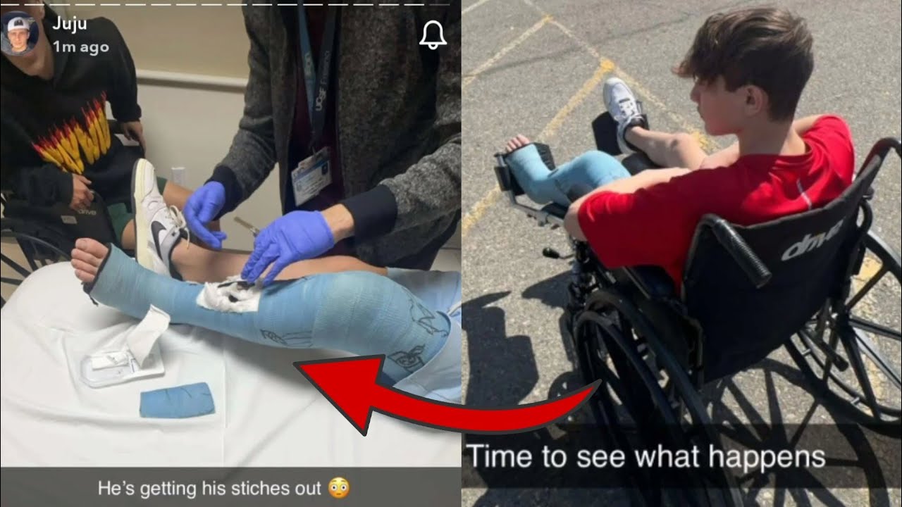 Nidal Wonder's STITCHES have been removed - YouTube