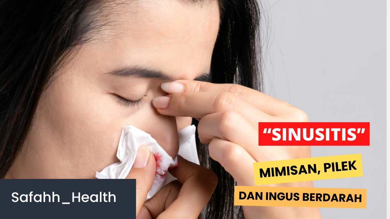 Sinusitis Mimisan, Pilek dan Ingus berdarah #safahhhealth #irigasinasal ...