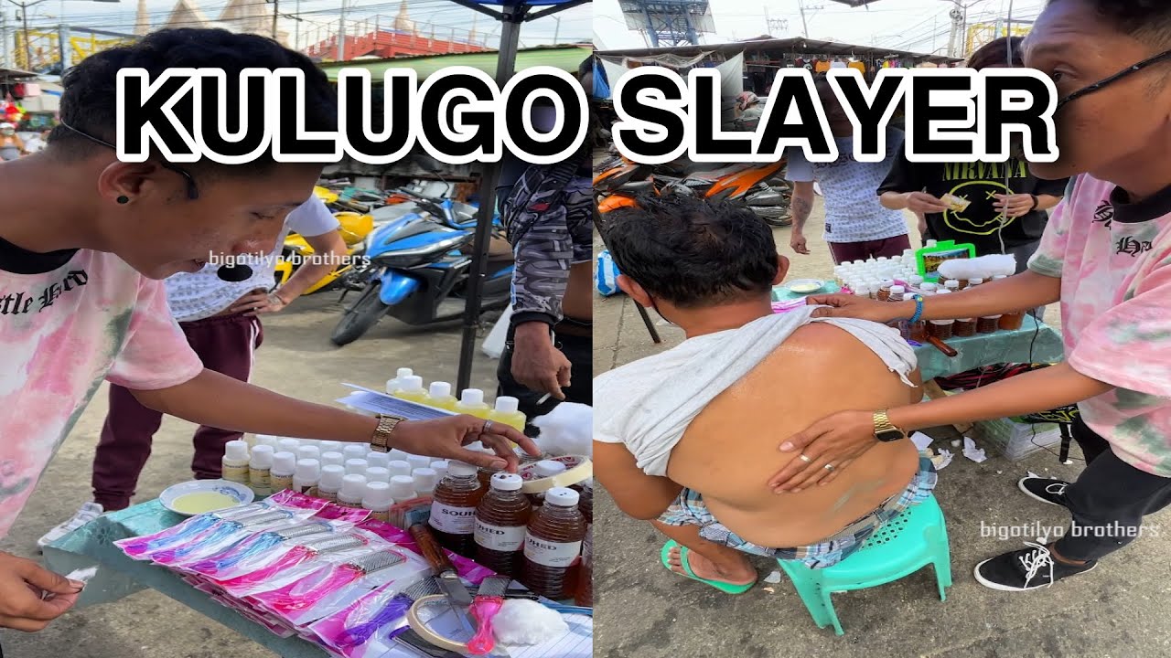 Magic Kulugo Remover and Anti Lamig - YouTube