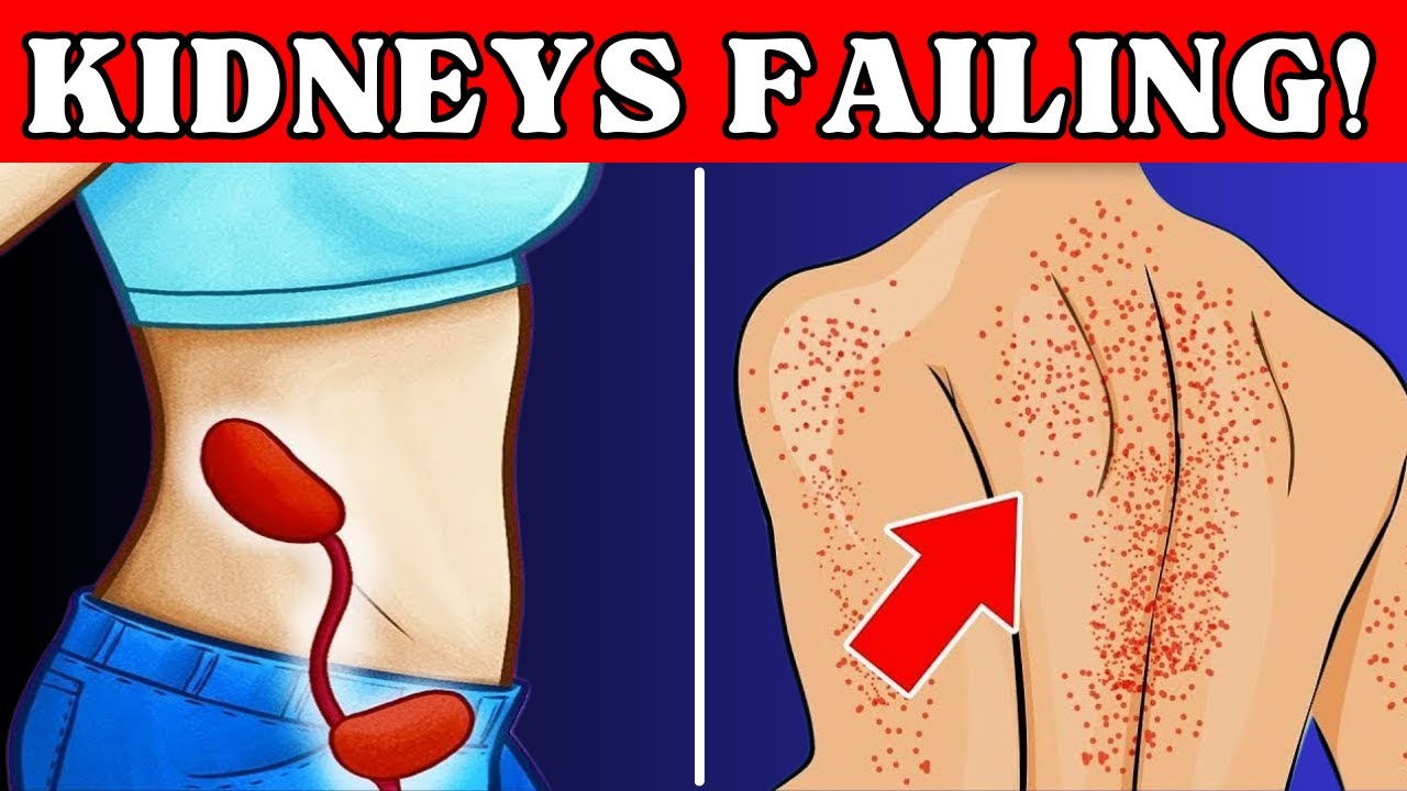 10 SIGNS Your KIDNEYS Are Urgently Asking for Help! SIGNS and SYMPTOMS ...