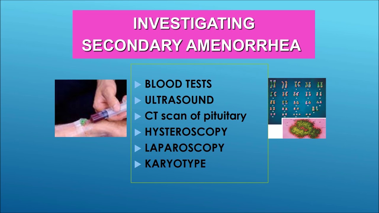 SECONDARY AMENORRHEA investigation & diagnosis - YouTube