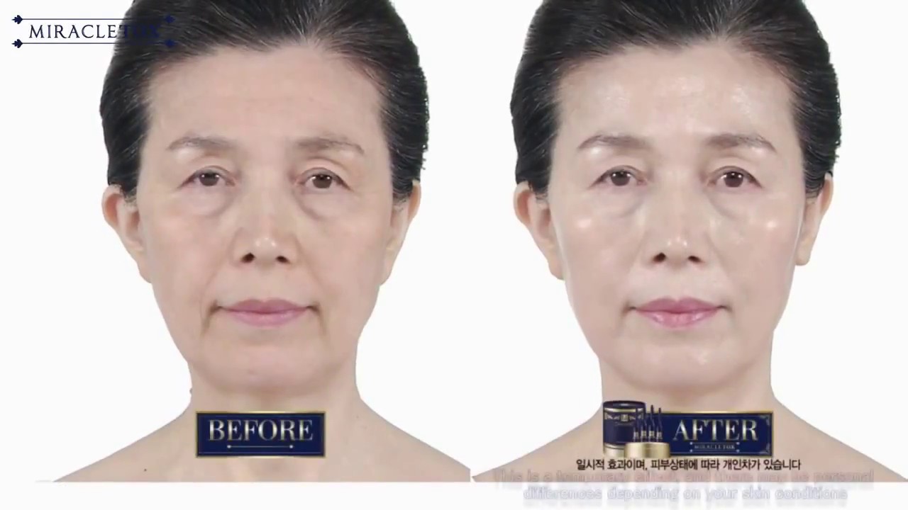 Korean MIRACLETOX Time Rewind Feel Cream and Tox Ampoule with the Micro ...