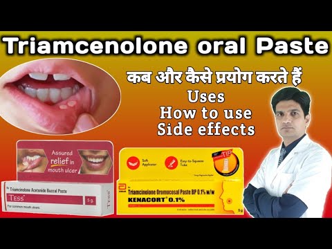 Kenacort 0.1 | Kenacort gel how to use | Triamcinolone oromucosal paste ...