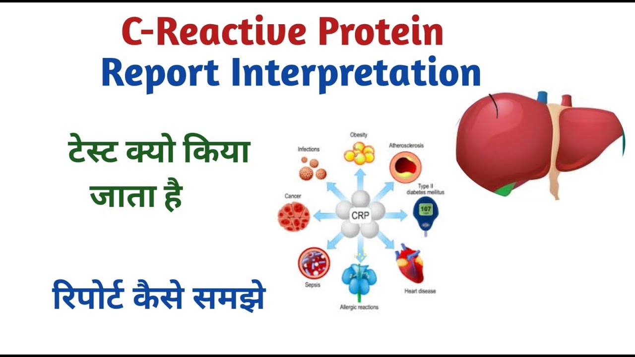 CRP Test Report Interpretation I Crp Blood Test YouTube crp-test-report-interpretation-i-crp-blood-test-youtube