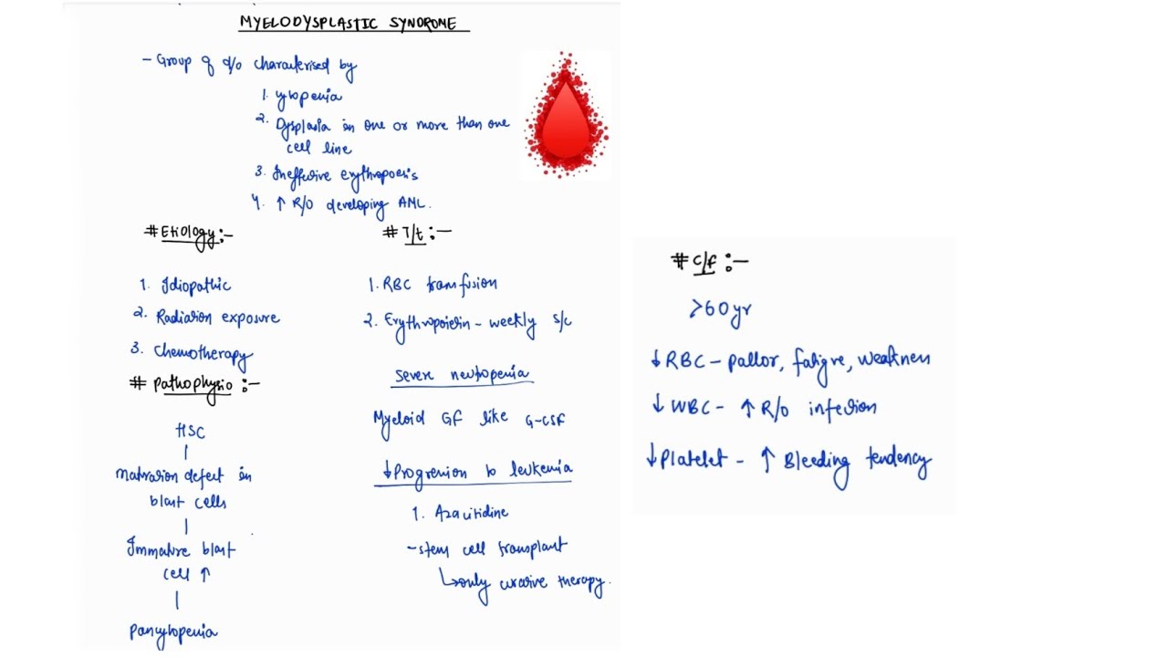 MYELODYSPLASTIC SYNDROME NOTES | ONE PAGE NOTE |HEMATOLOGY | MEDICINE ...
