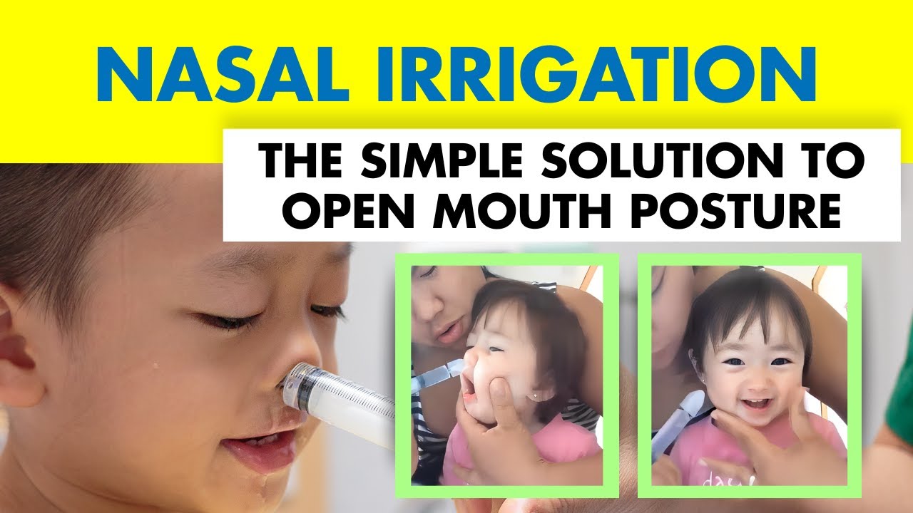 Nasal Irrigation: The Simple Solution to Open Mouth Posture - YouTube
