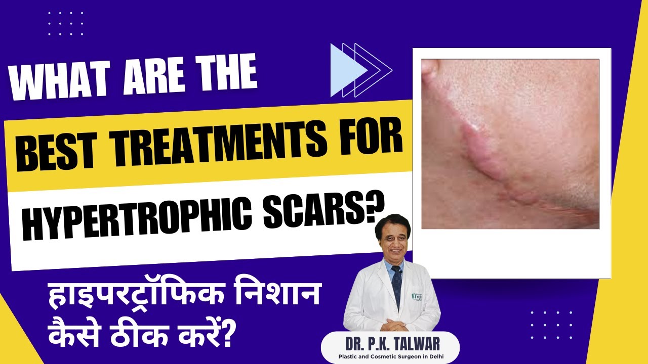 Best Treatment for Hypertrophic Scars on Face | Scar Treatment Clinic ...