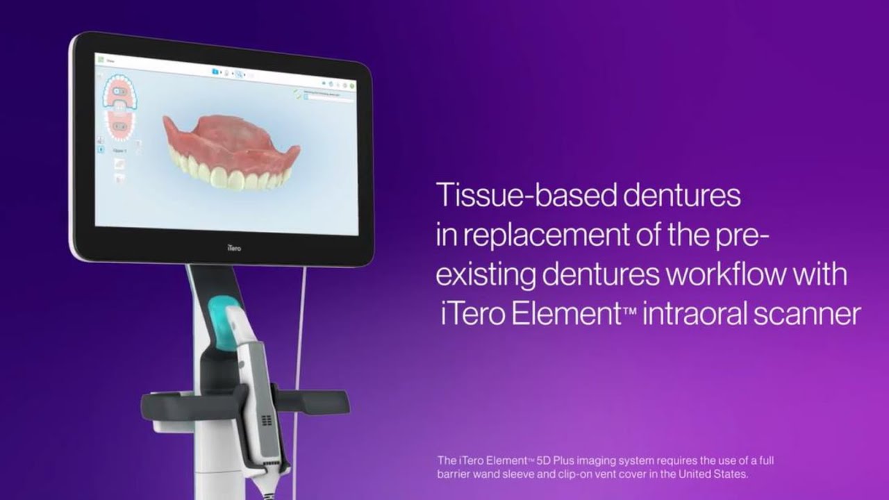 How to scan dentures with the iTero Element™ Plus scanner | tissue ...
