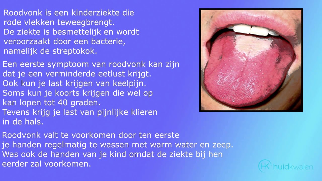 Roodvonk [Informatie + Tips] - YouTube