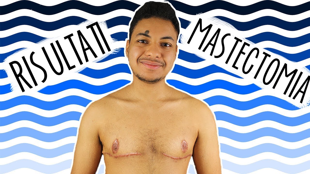Vi mostro i risultati della MASTECTOMIA | Richard Thunder - YouTube
