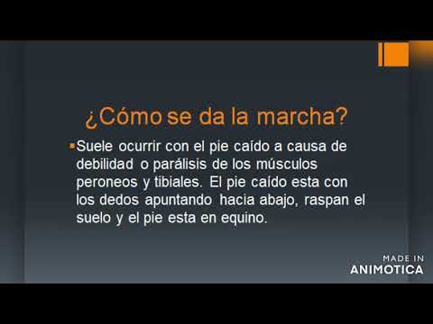 Descripción de marcha Equina o Steppage - YouTube