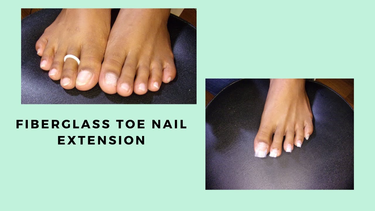 Fiberglass Toe Nails - YouTube