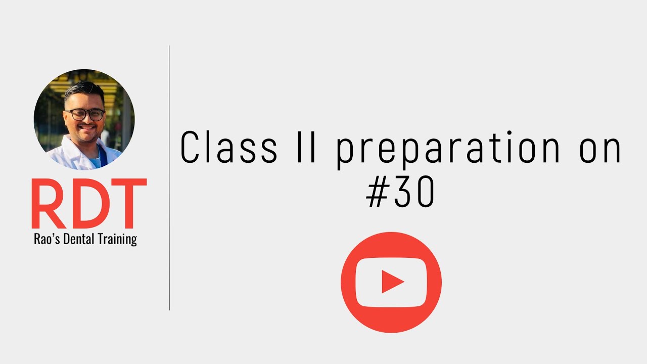 Stepwise Class II preparation on #30 (MO) - YouTube