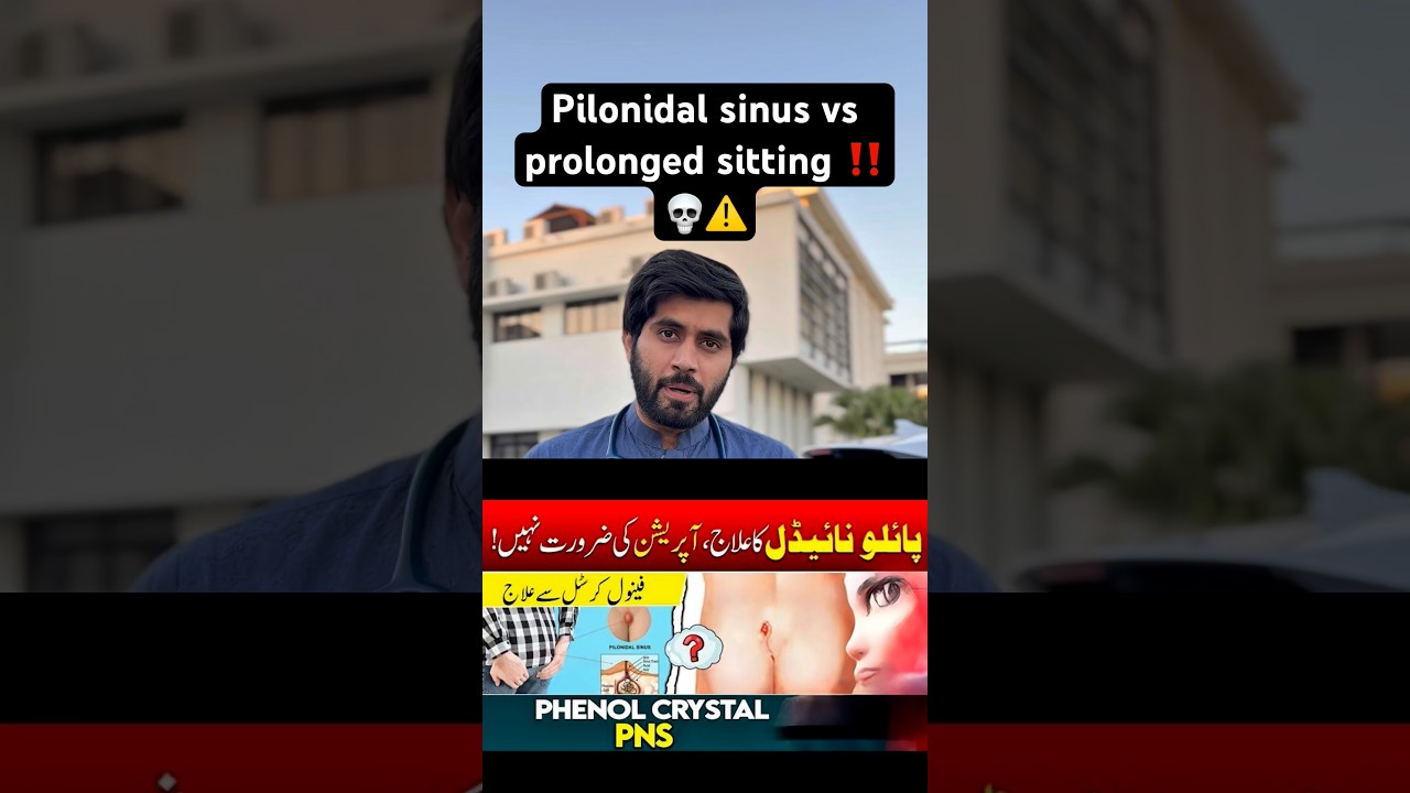 Pilonidal sinus causes and treatment.#pilonidalsinus #drivers #banker # ...