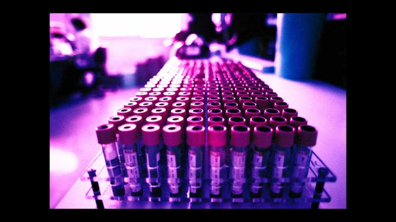 sickle cell project.wmv - YouTube