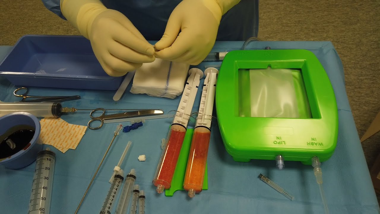 LIPO-STEM™ SURGICAL SESSION: Adipose-Derived Mesenchymal Stem Cells ...