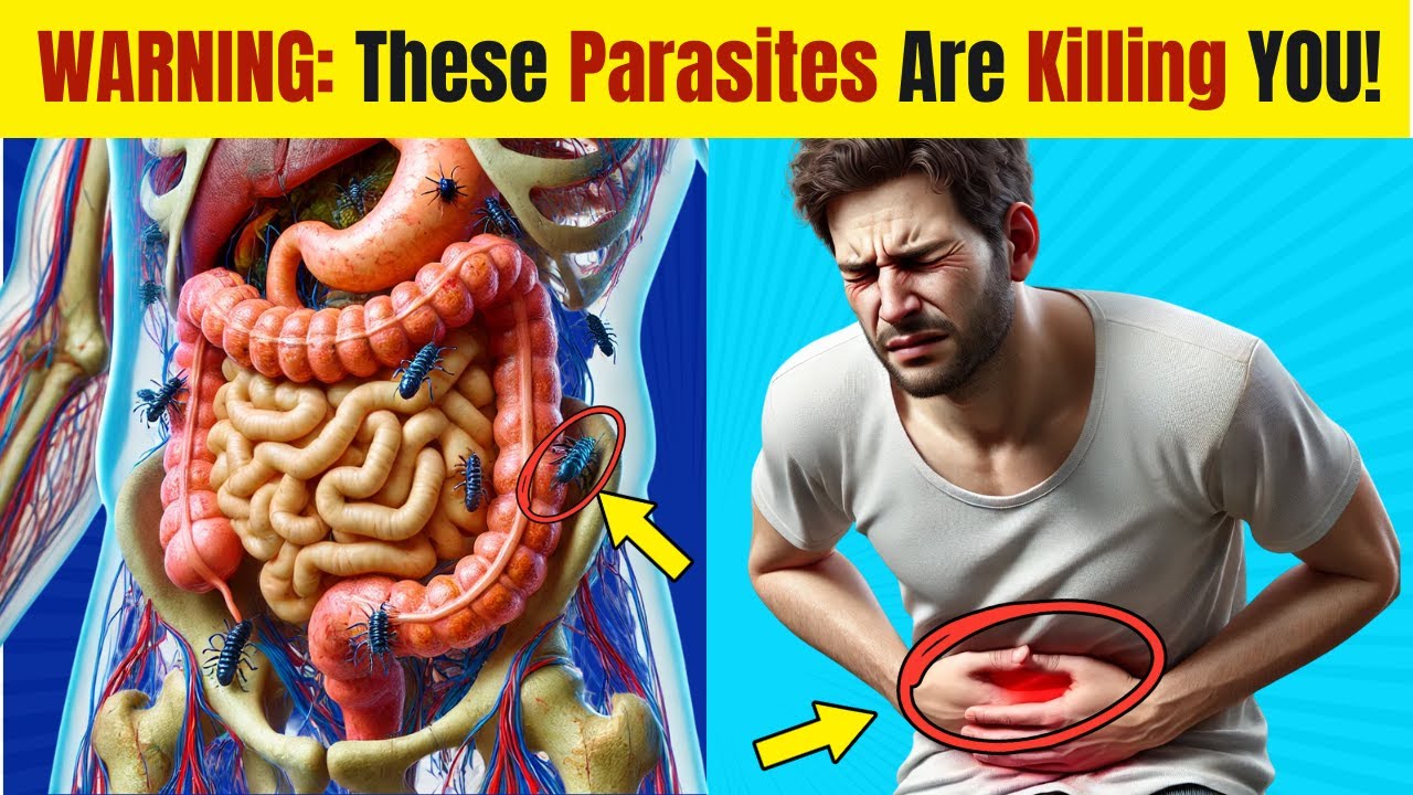 PARASITES Stealing Health! 10 Foods to Eliminate Them Fast! - YouTube